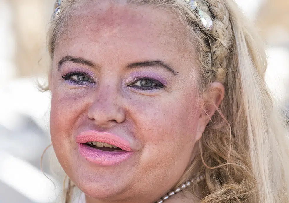 Johanna Tukiainen Before After