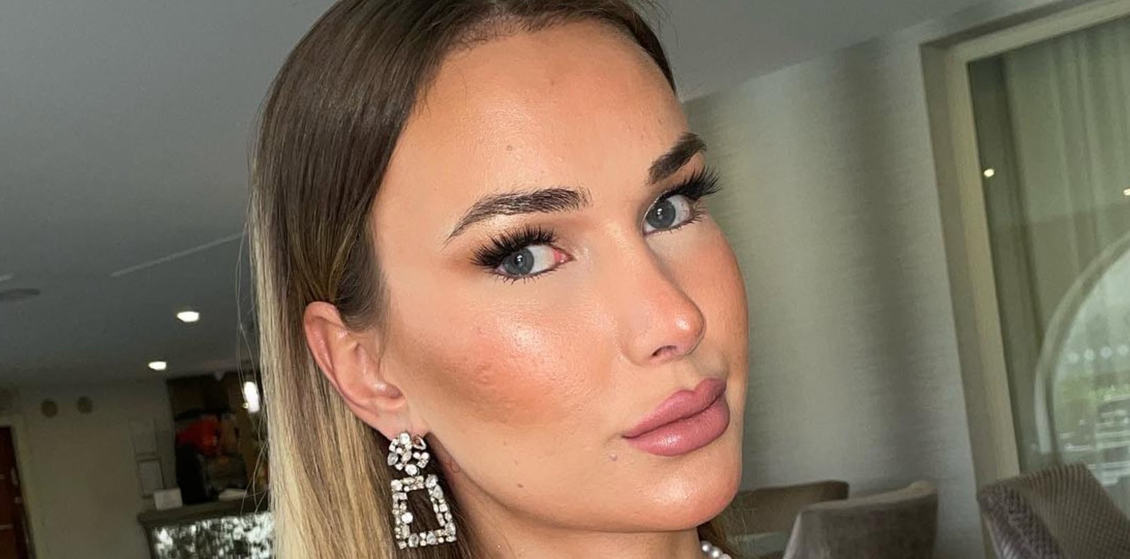 BB-Sofia näytti hurjalta 8 operaation jälkeen - tässä lopputulos nyt! - Como.fi